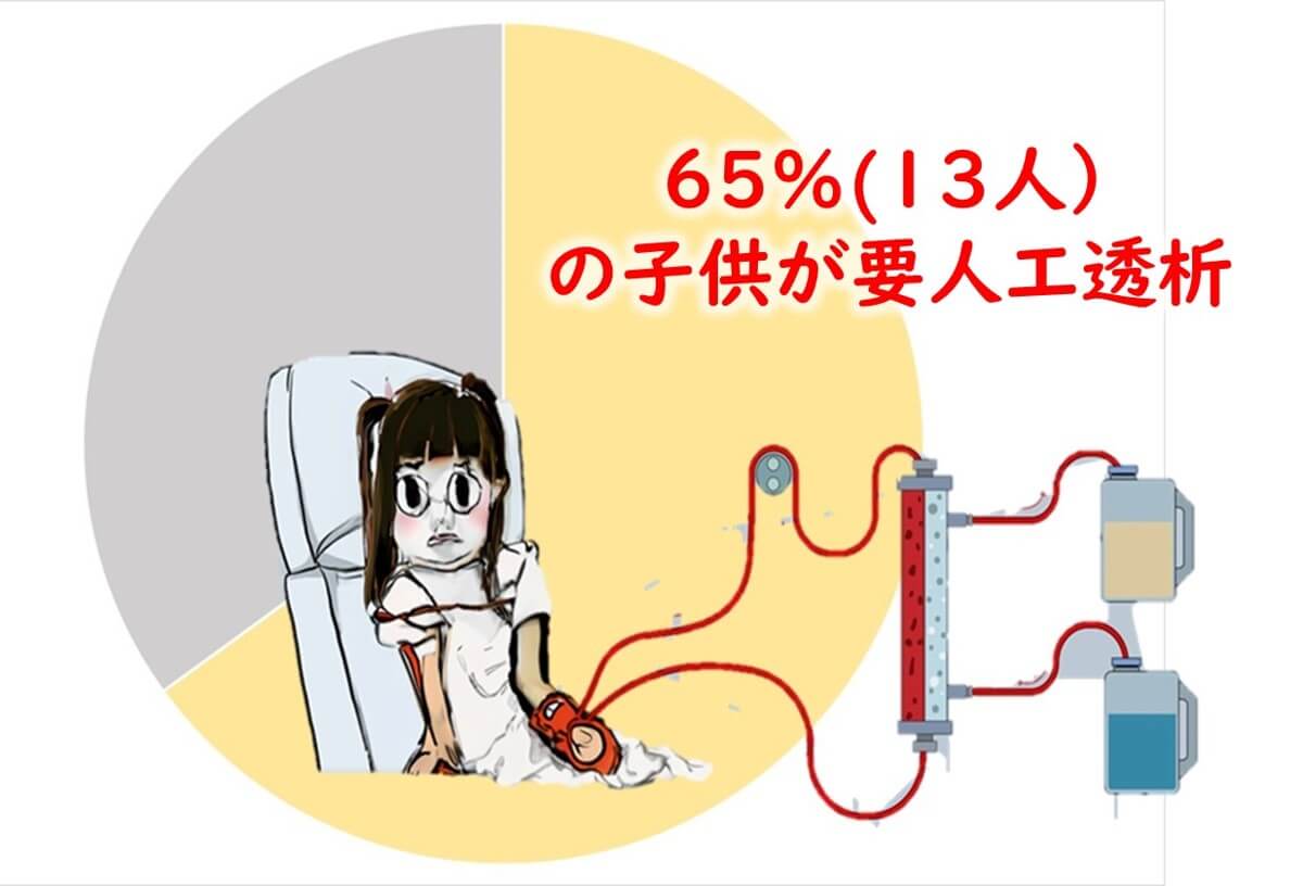 腸管出血性大腸菌O26はO157と比べるとどれくらい危険？ | 食品微生物学（検査と制御方法）｜基礎と最新情報を解説｜木村 凡
